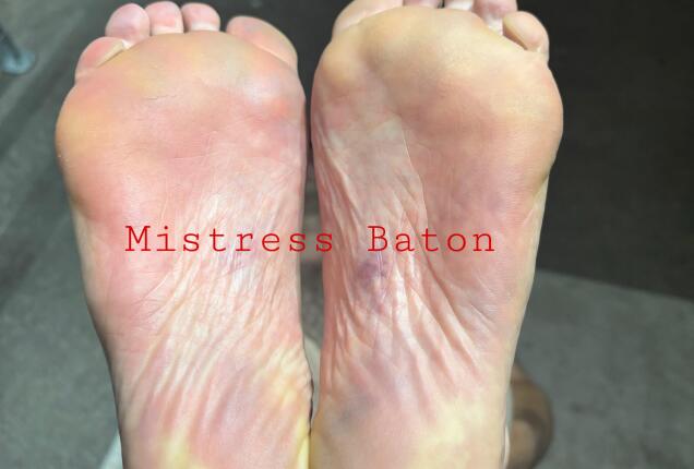 Bastinado Bruises - Mistress Baton Official Photos | LoyalFans