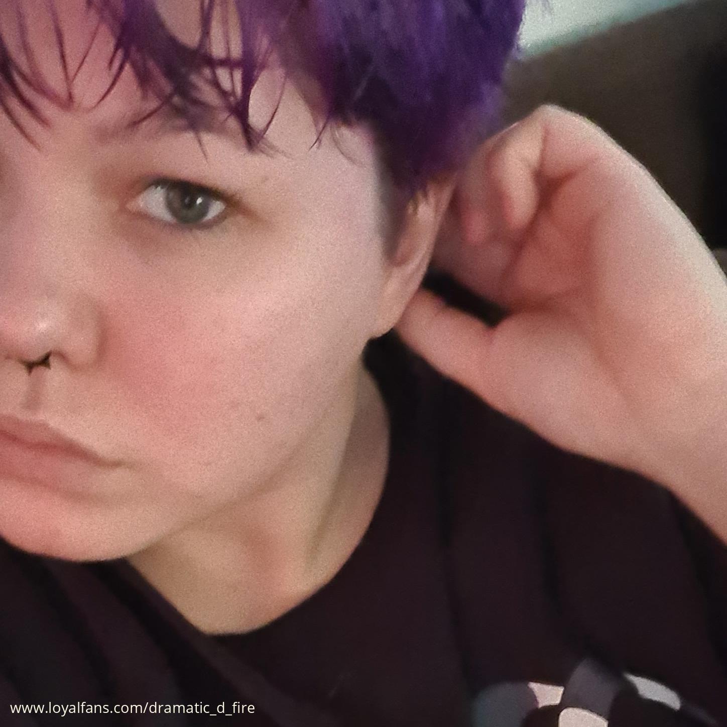 Dramatic dumpster fire's Official Social Fan Page | LoyalFans