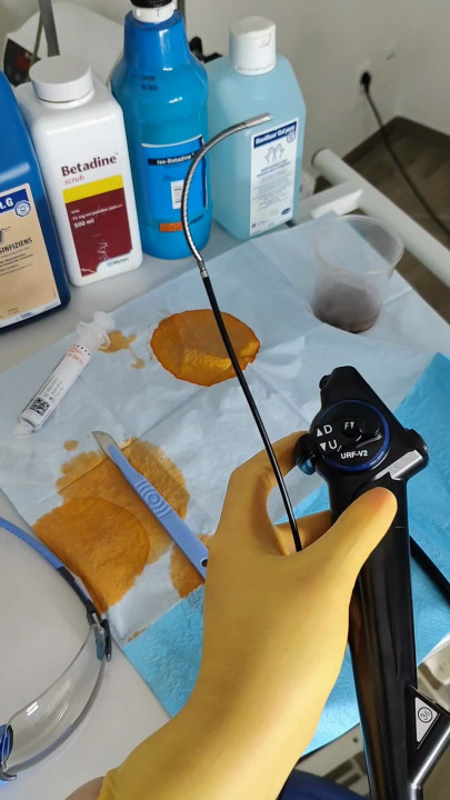 Olympus urf-V2 cystoscope - AmaraClinic Official Profile | LoyalFans